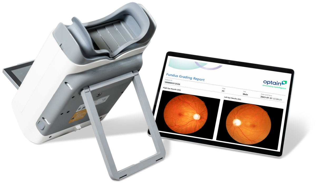 AI Retinal Imaging for Early Disease Detection | Optain Health
