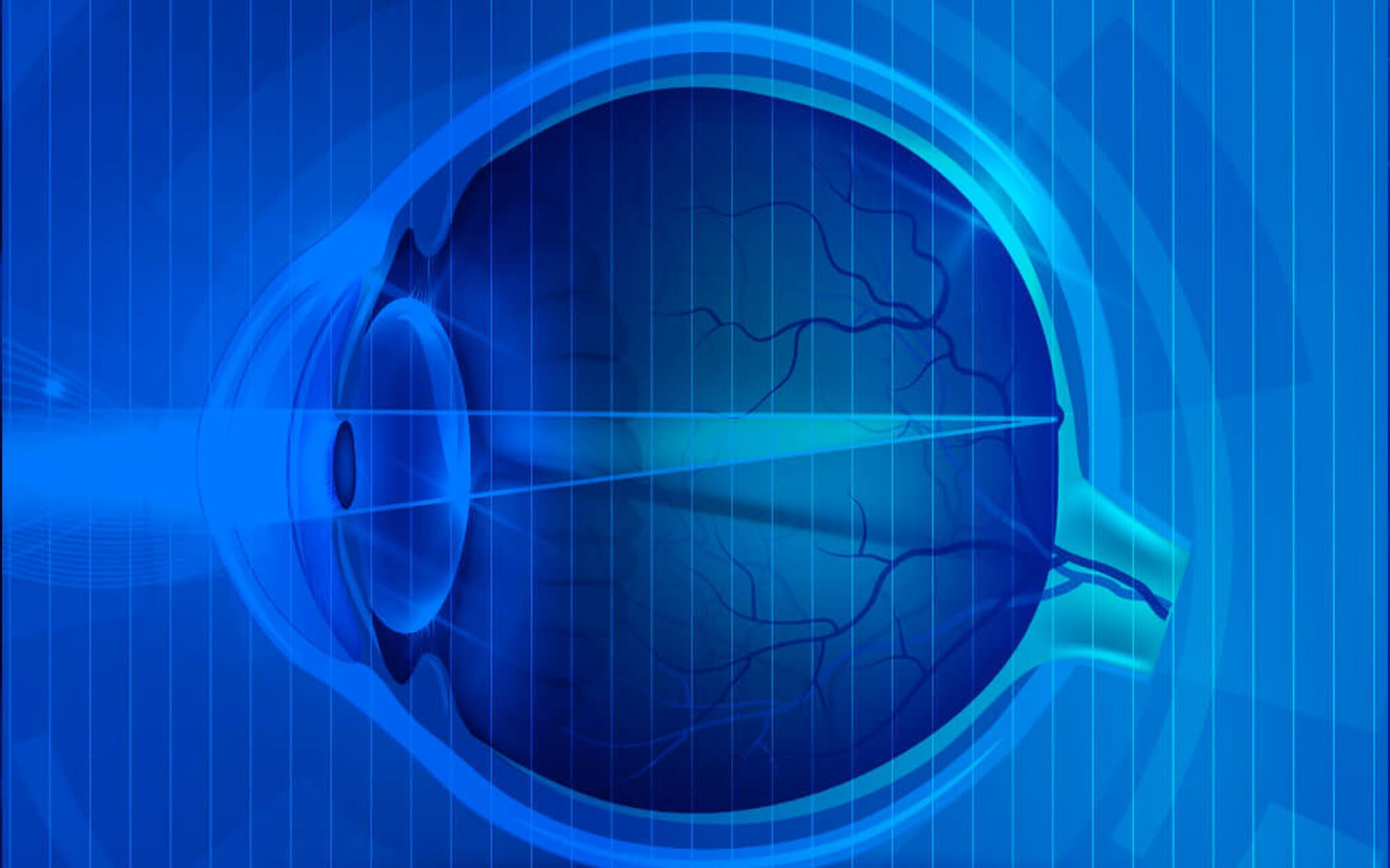 AI in Glaucoma Screening: Enhancing Eye Health | Optain Health